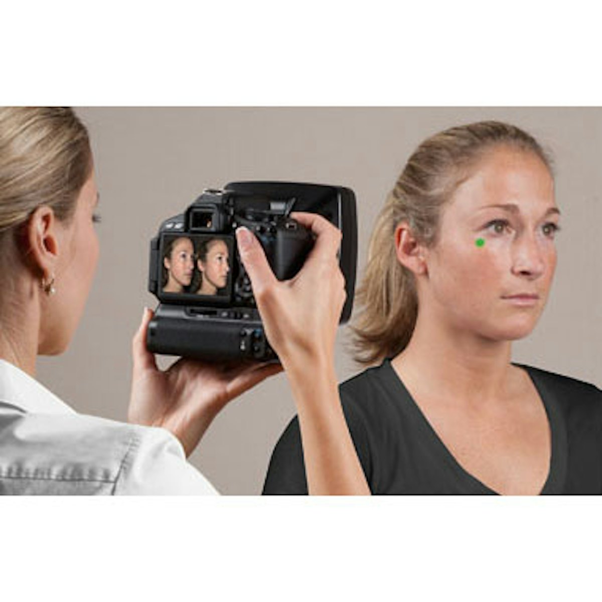 Skincare Equipment: Vectra H1 3D handheld camera | MedEsthetics