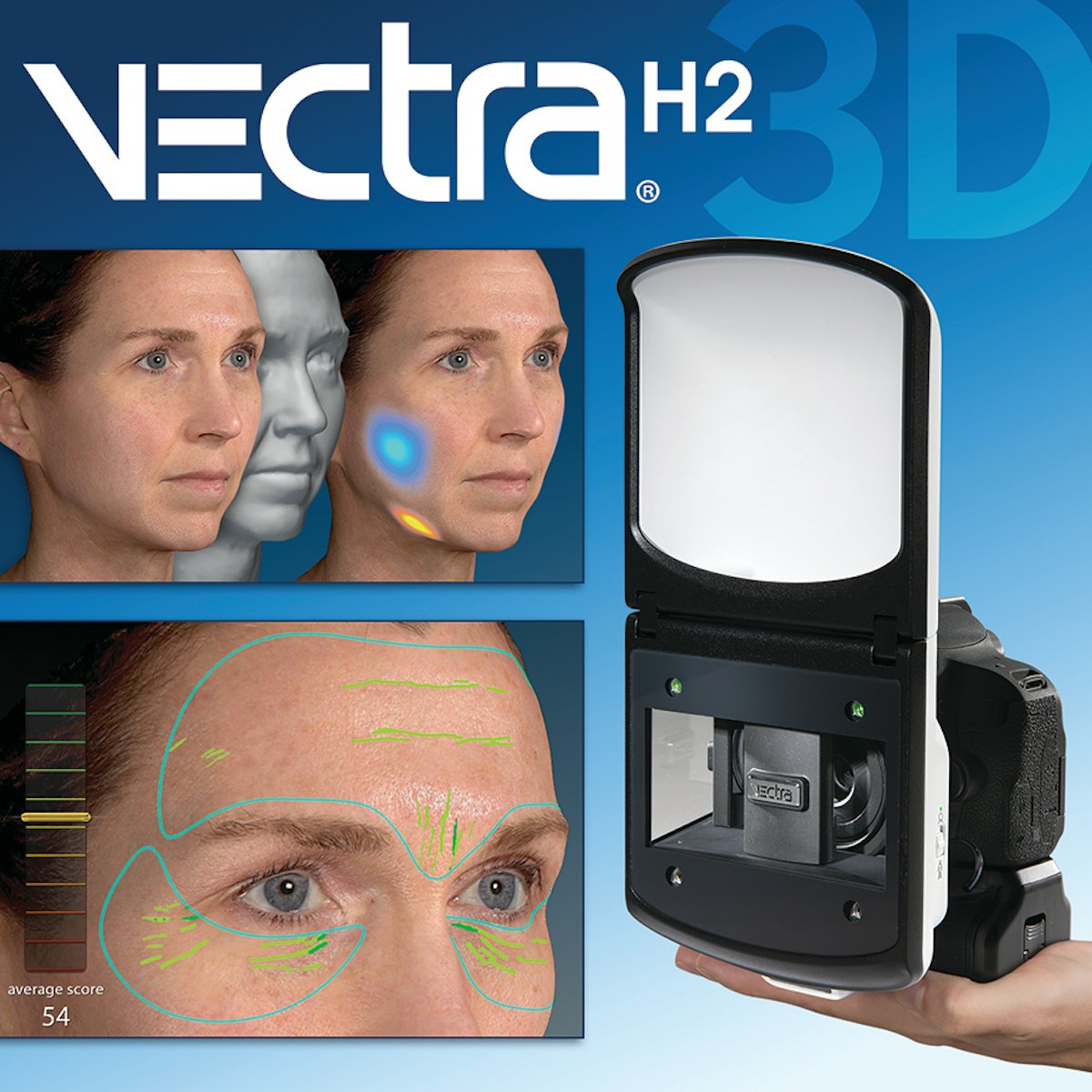 Canfield Imaging Systems Vectra H2 From: Canfield Imaging Systems ...