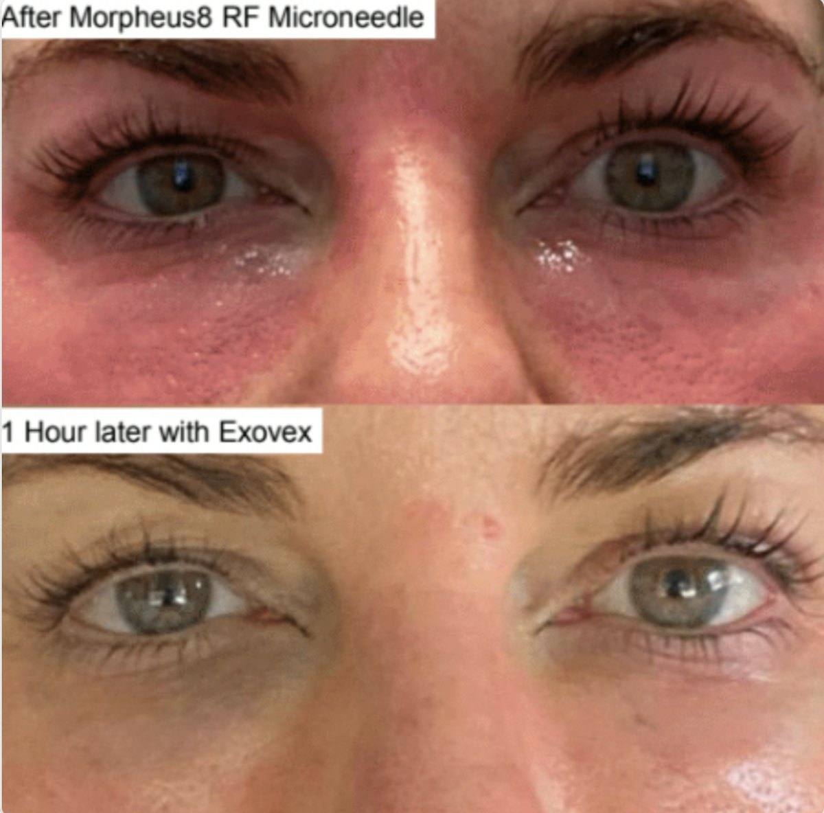 ExoCel Bio Uses Nanoparticle Technology to Produce Powerfully Potent ...