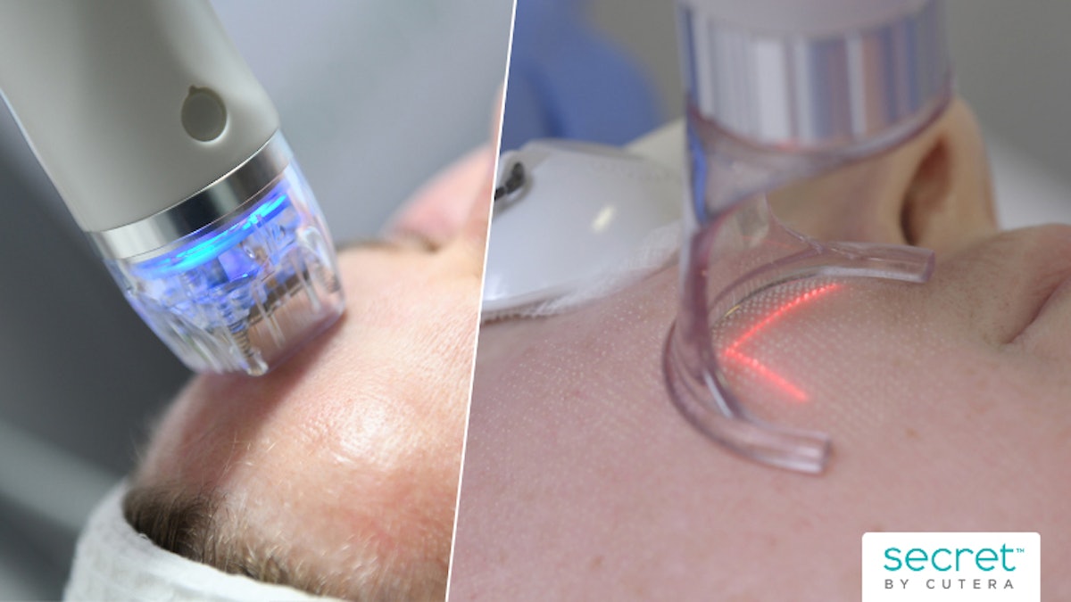 The New Graduated Approach to Skin Revitalization and Resurfacing | MedEsthetics