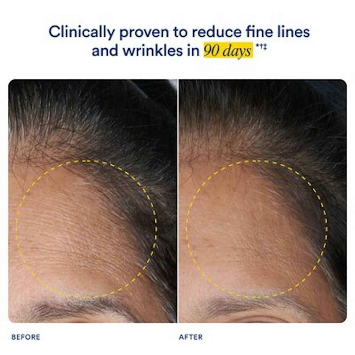 Ritual's HyaCera Reduces Wrinkles and Fine Lines to Improve Skin ...