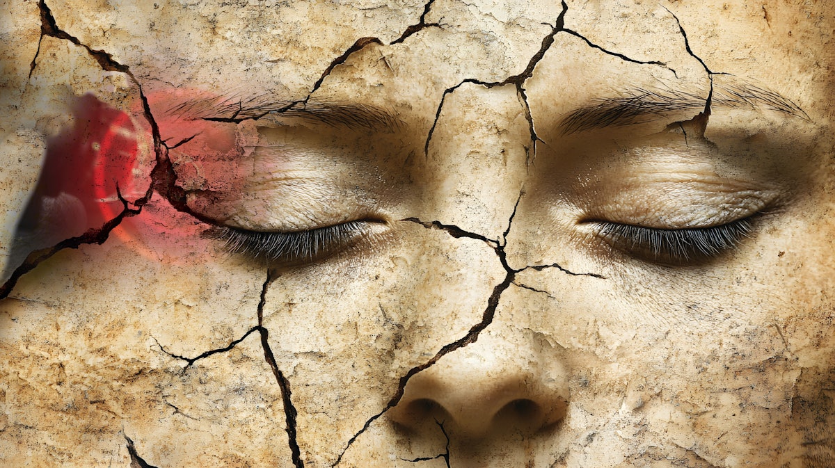 Scar Revision Techniques: Exploring the Latest Treatment Innovations ...