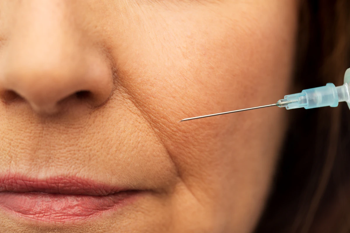 Galderma Study: Restylane + Sculptra Restore Facial Volume from Weight ...